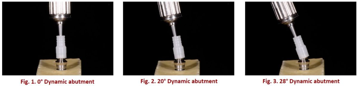 STUDY OF THE INFLUENCE OF ABUTMENT ANGULATION ON SCREW FRACTURE ...