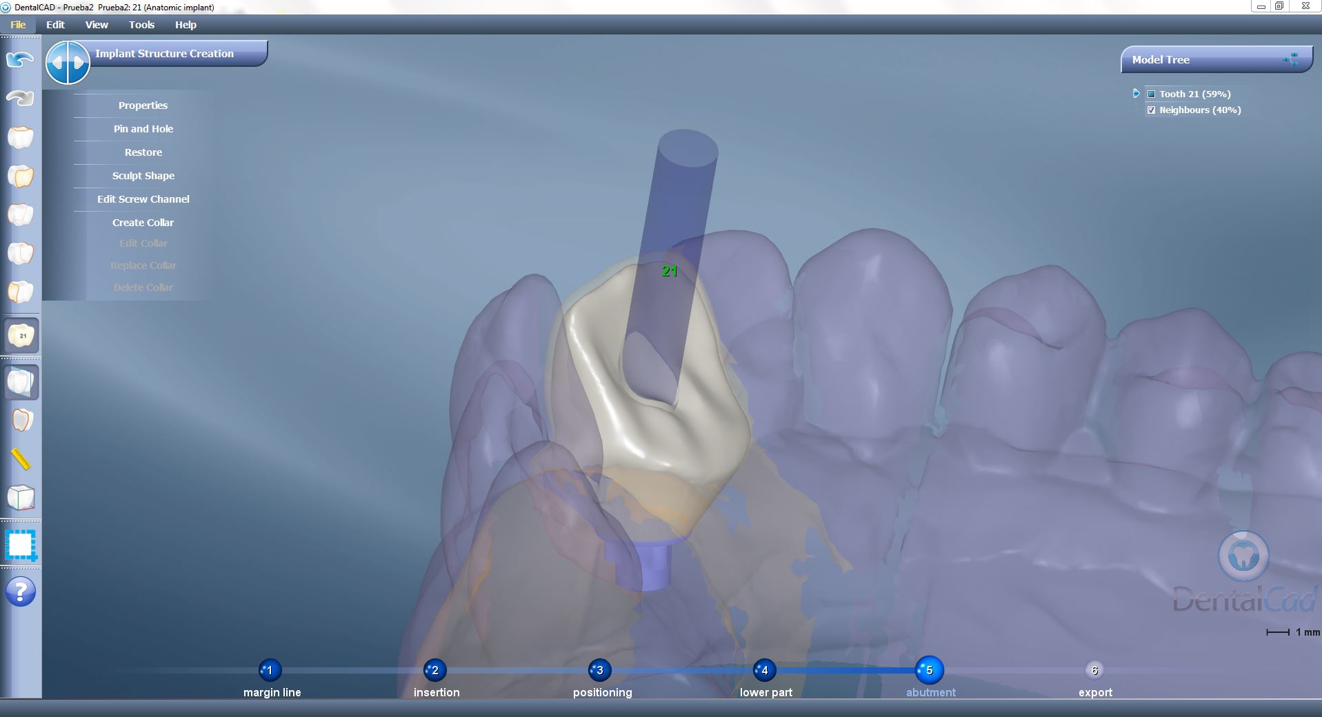 EVERYTHING STARTS WITH A GOOD DESIGN… | Dynamic Abutment Solutions EN