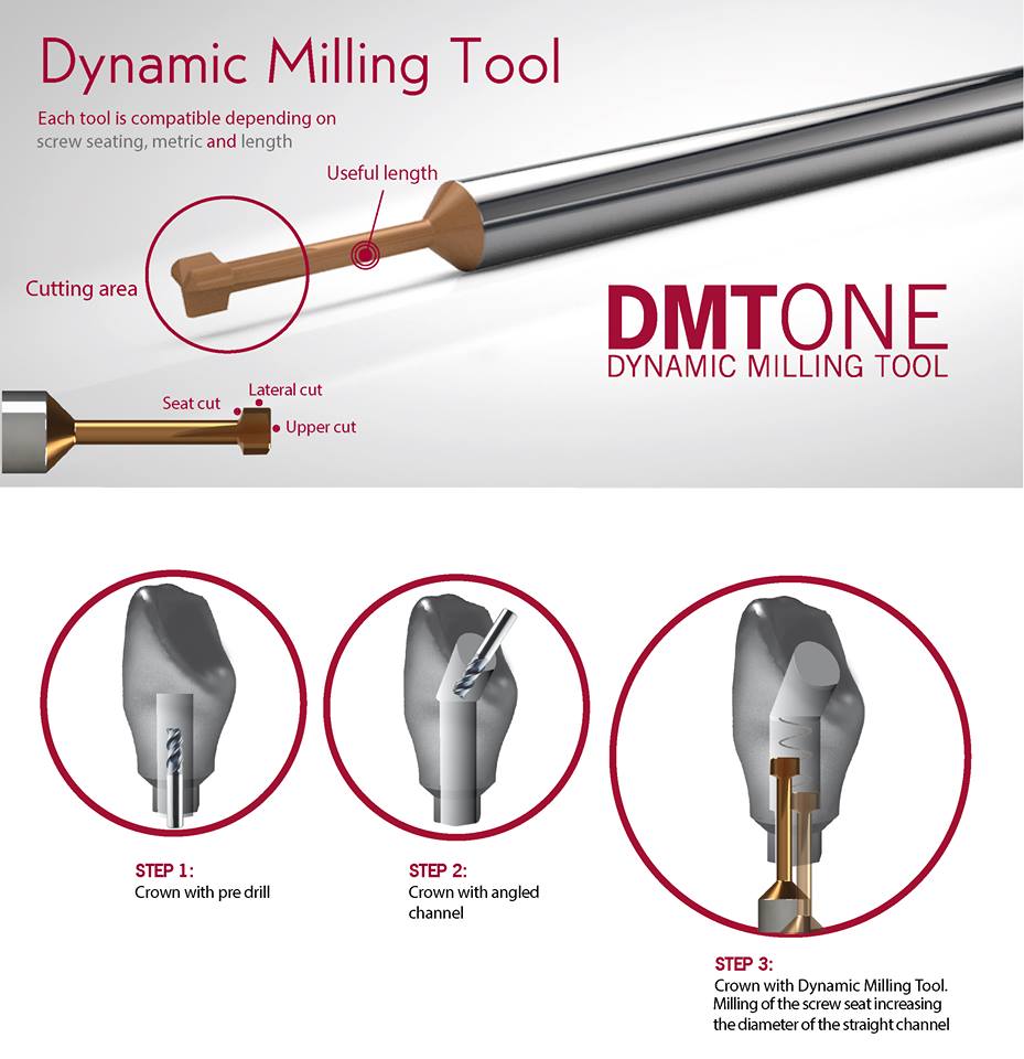 Dynamic Milling Tool Dynamic Abutment Solutions En