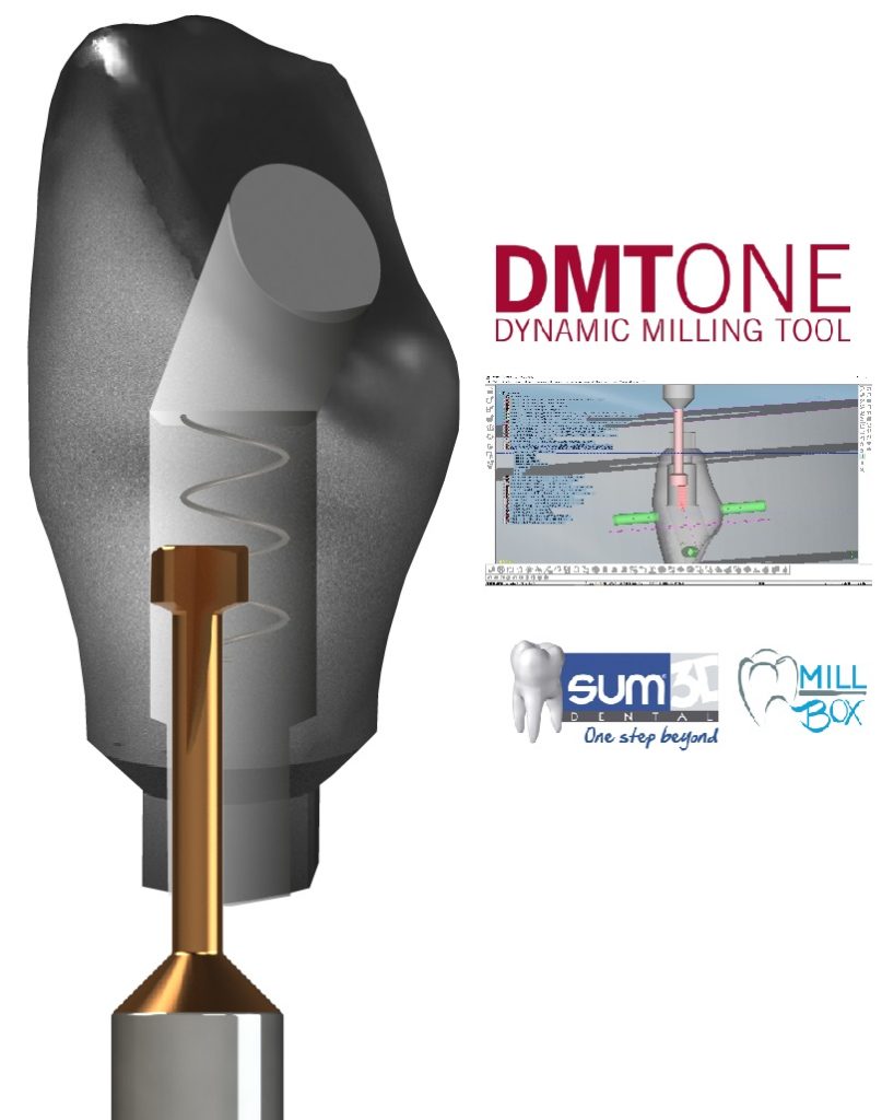 DMTONE VALIDATED BY SUM3D – MILLBOX | Dynamic Abutment Solutions EN