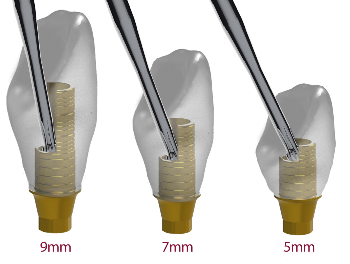 PRODUCT DYNAMIC TIBASE | Dynamic Abutment Solutions EN