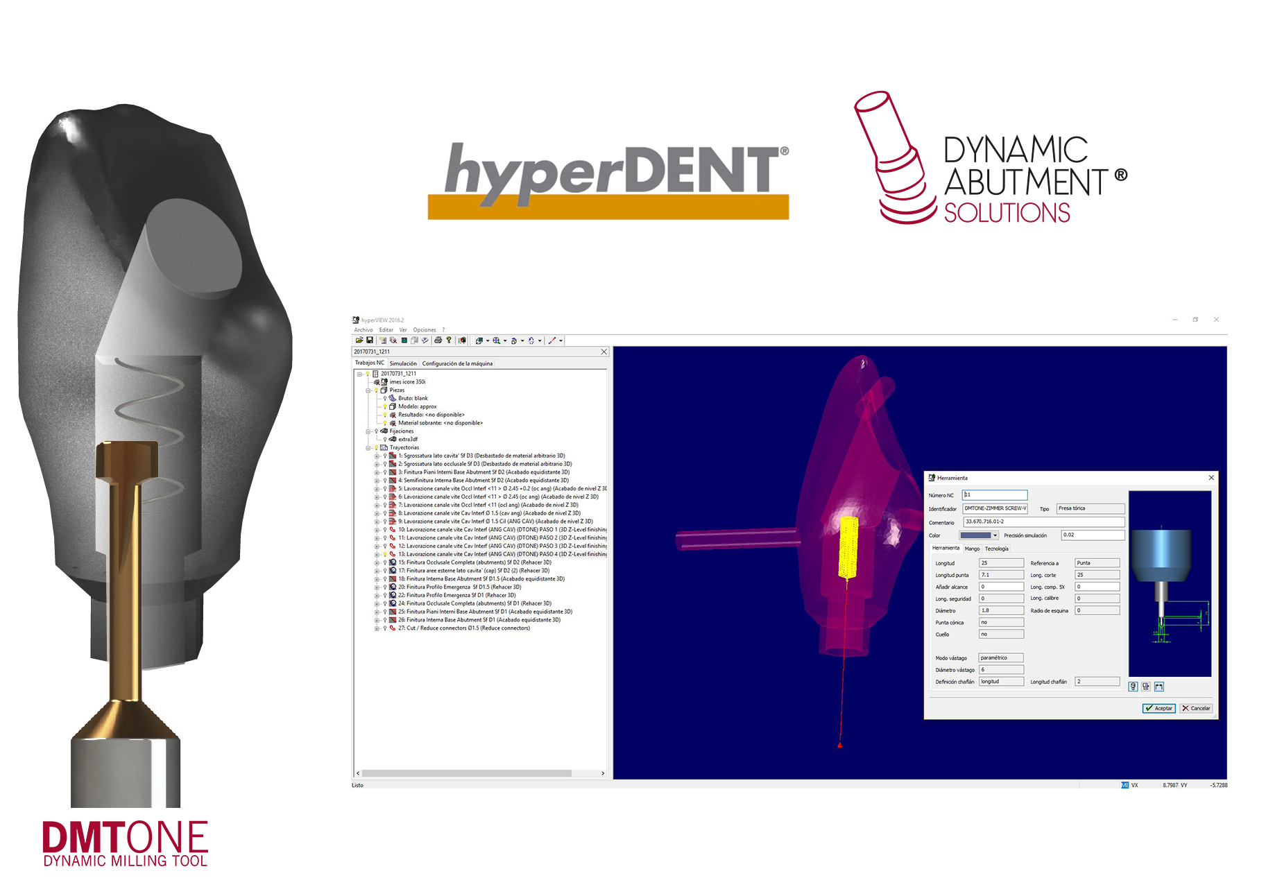DMTONE VALIDATED BY HYPERDENT | Dynamic Abutment Solutions EN