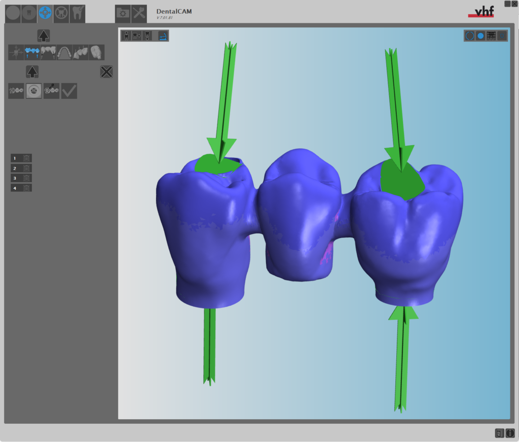 DentalCAM-dynamic-abutment | Dynamic Abutment Solutions EN