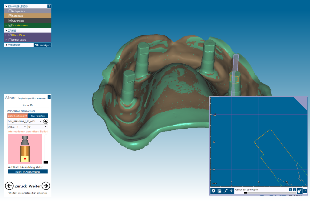 ScAnalog: A NEW CONCEPT OF WORK | Dynamic Abutment Solutions EN