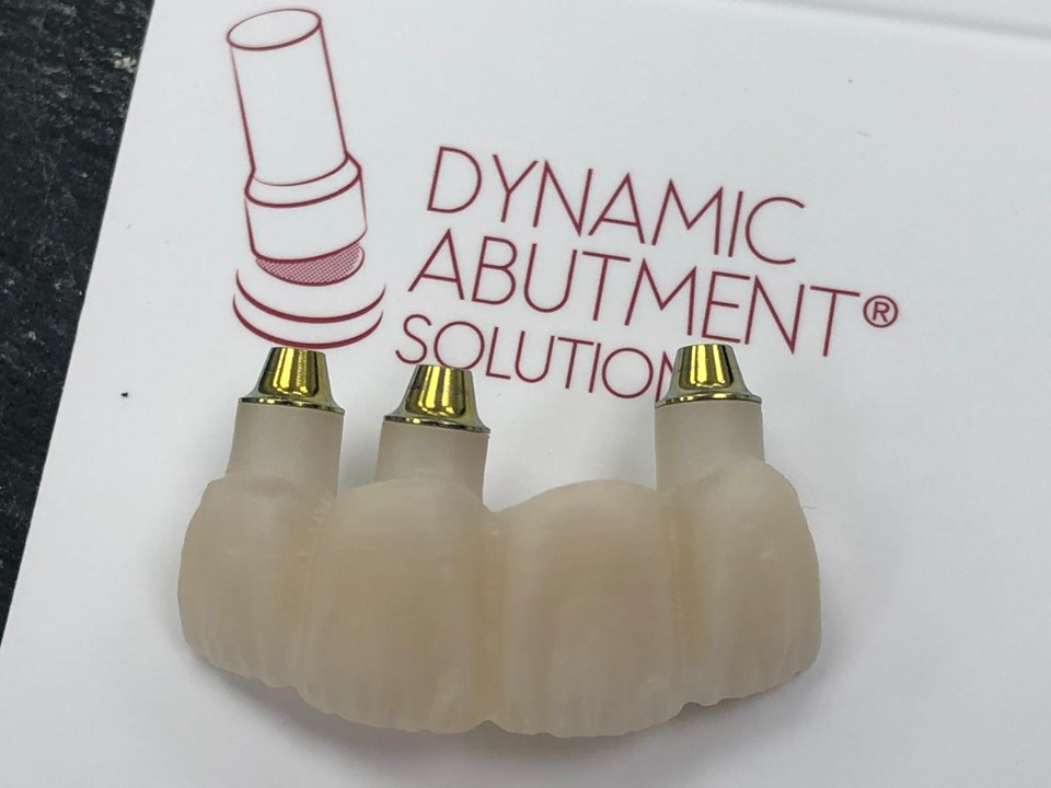 DYNAMIC TIBASE CASE | Dynamic Abutment Solutions EN