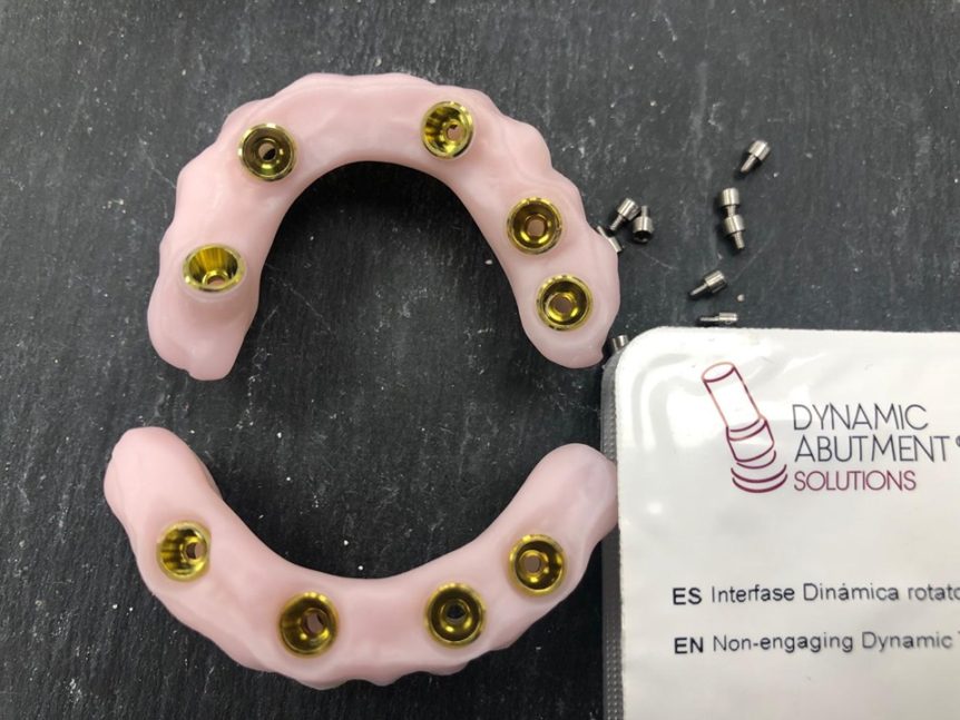 Case with our Tibase® | Dynamic Abutment Solutions EN