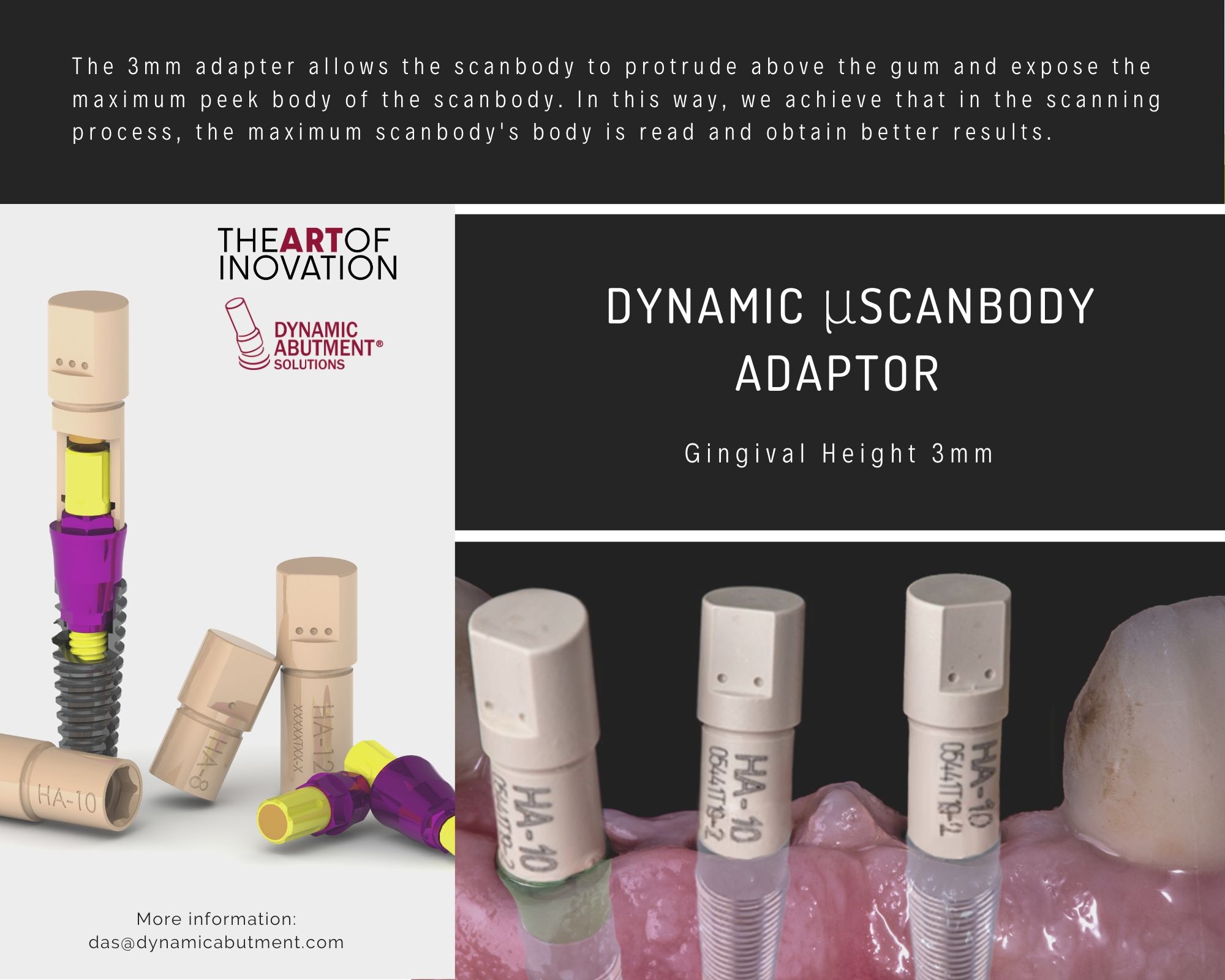 The Dynamic µScanbody 3mm adaptor! | Dynamic Abutment Solutions EN