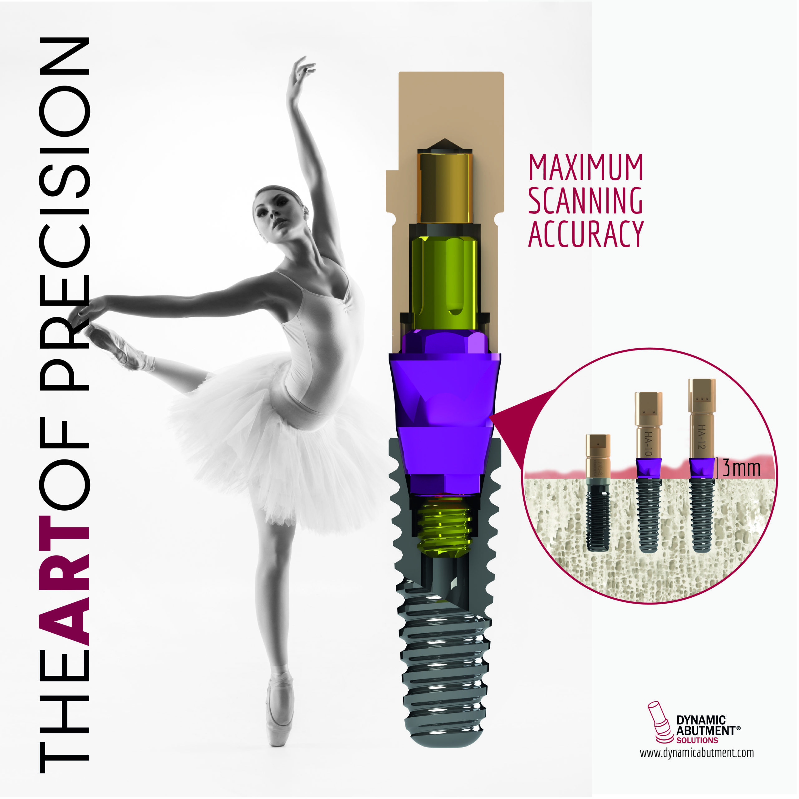 THE ART OF PRECISION - Dynamic Abutment Solutions EN