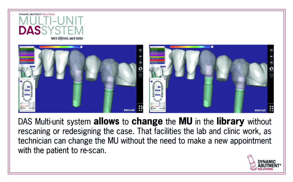 DAS MULTI-UNIT SYSTEM: WORK DIFFERENT, WORK BETTER… | Dynamic Abutment ...