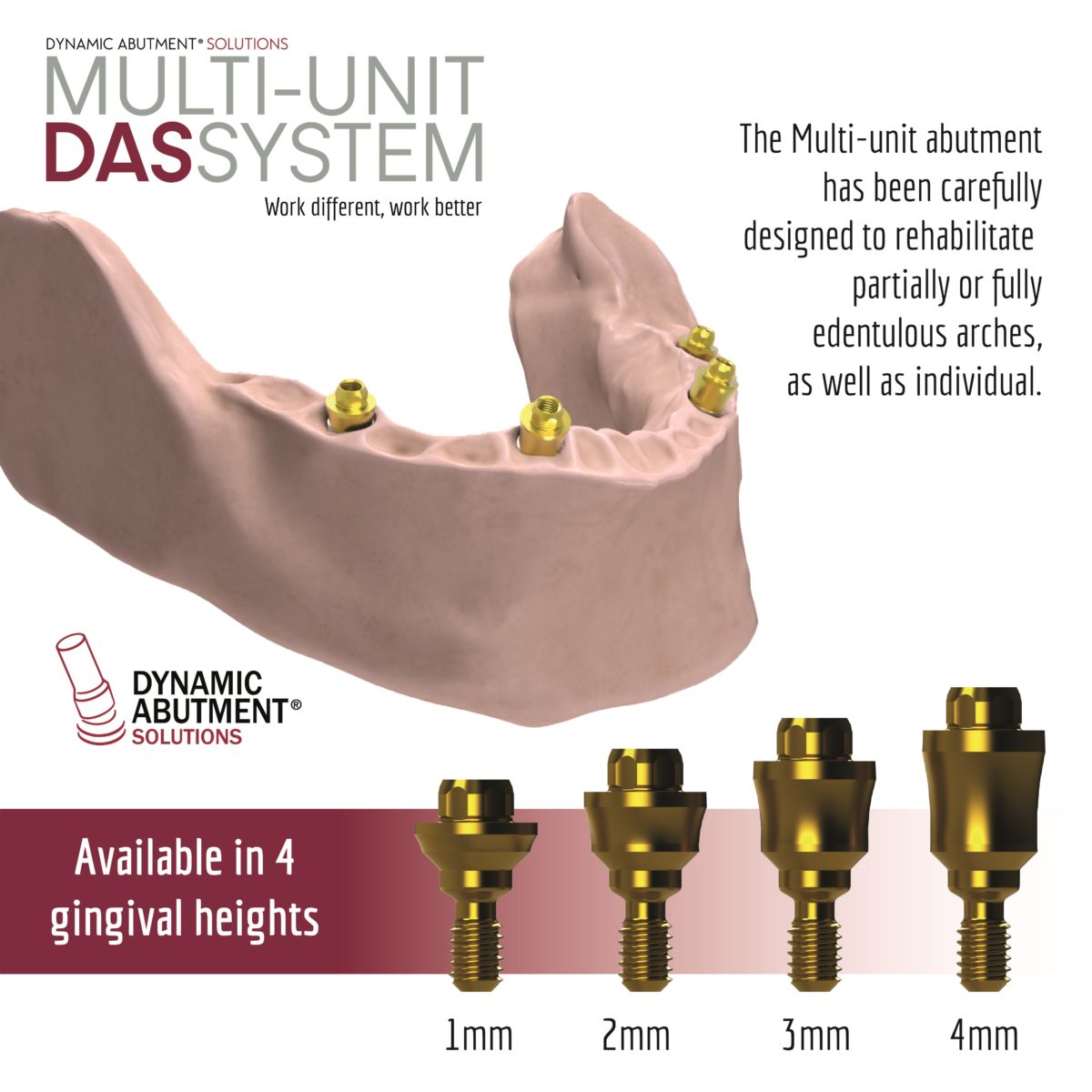 MULTI-UNIT DAS SYSTEM | Dynamic Abutment Solutions EN