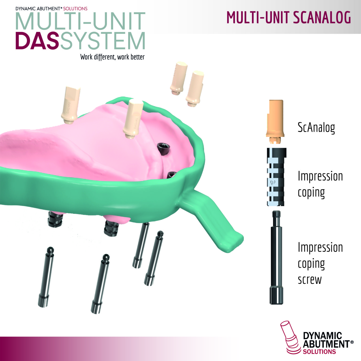 Multi-Unit DAS System: ScAnalog | Dynamic Abutment Solutions EN
