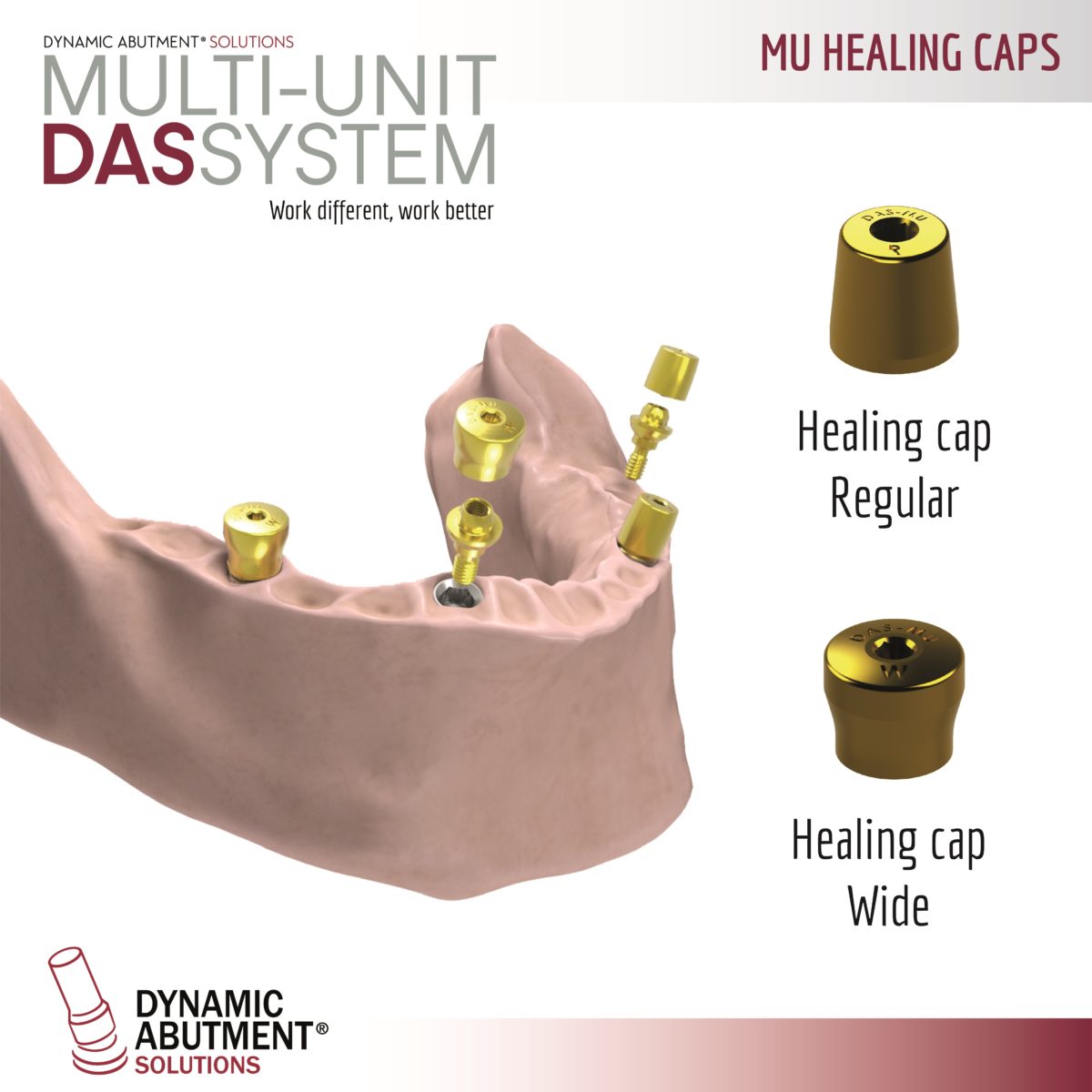 Multi-Unit DAS System: Healings Caps | Dynamic Abutment Solutions EN