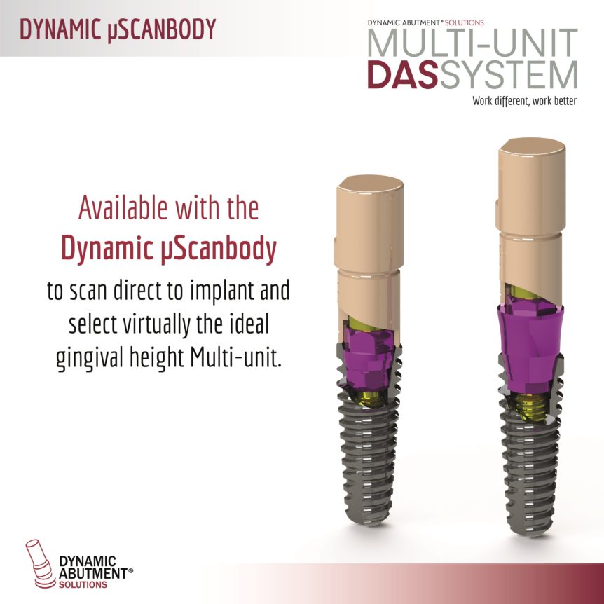 Dynamic µScanbody | Dynamic Abutment Solutions EN