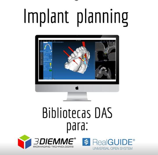 3diemme implant planning | Dynamic Abutment Solutions EN