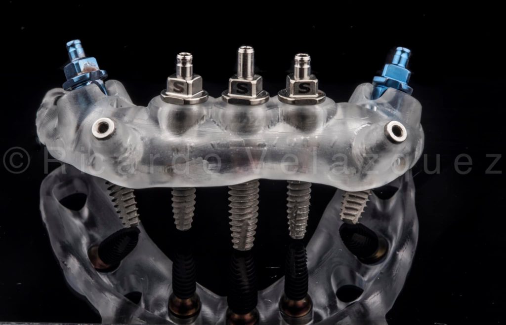 DAS libraries available for 3DIEMME | Dynamic Abutment Solutions EN