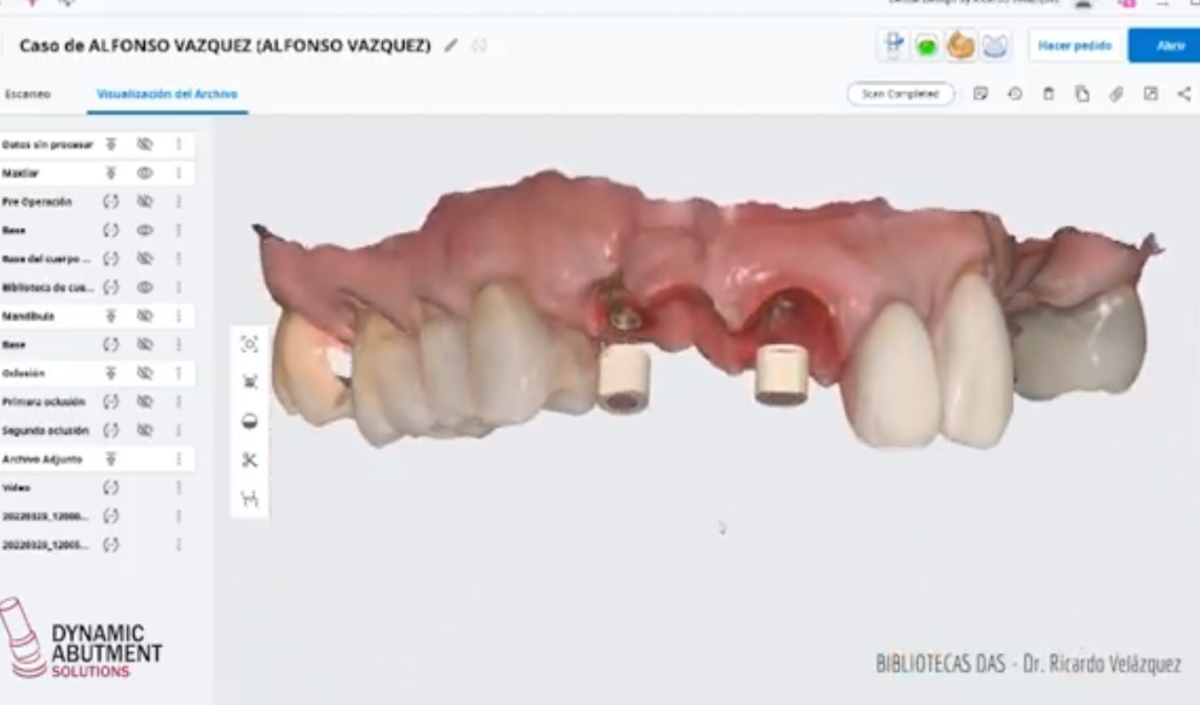 Dynamic Abutment Solutions EN