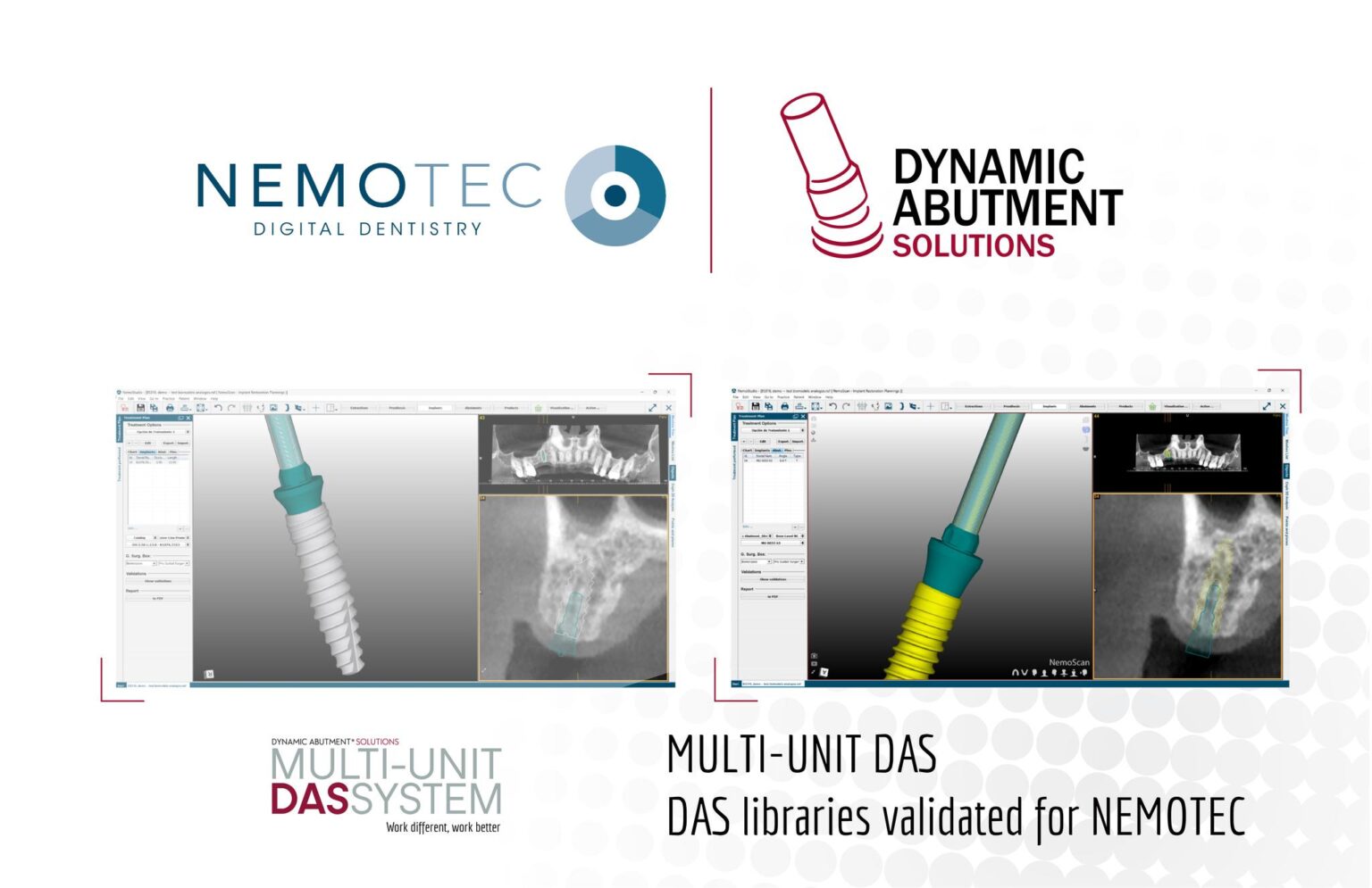 DAS NEWS 2023-04 | Dynamic Abutment Solutions EN