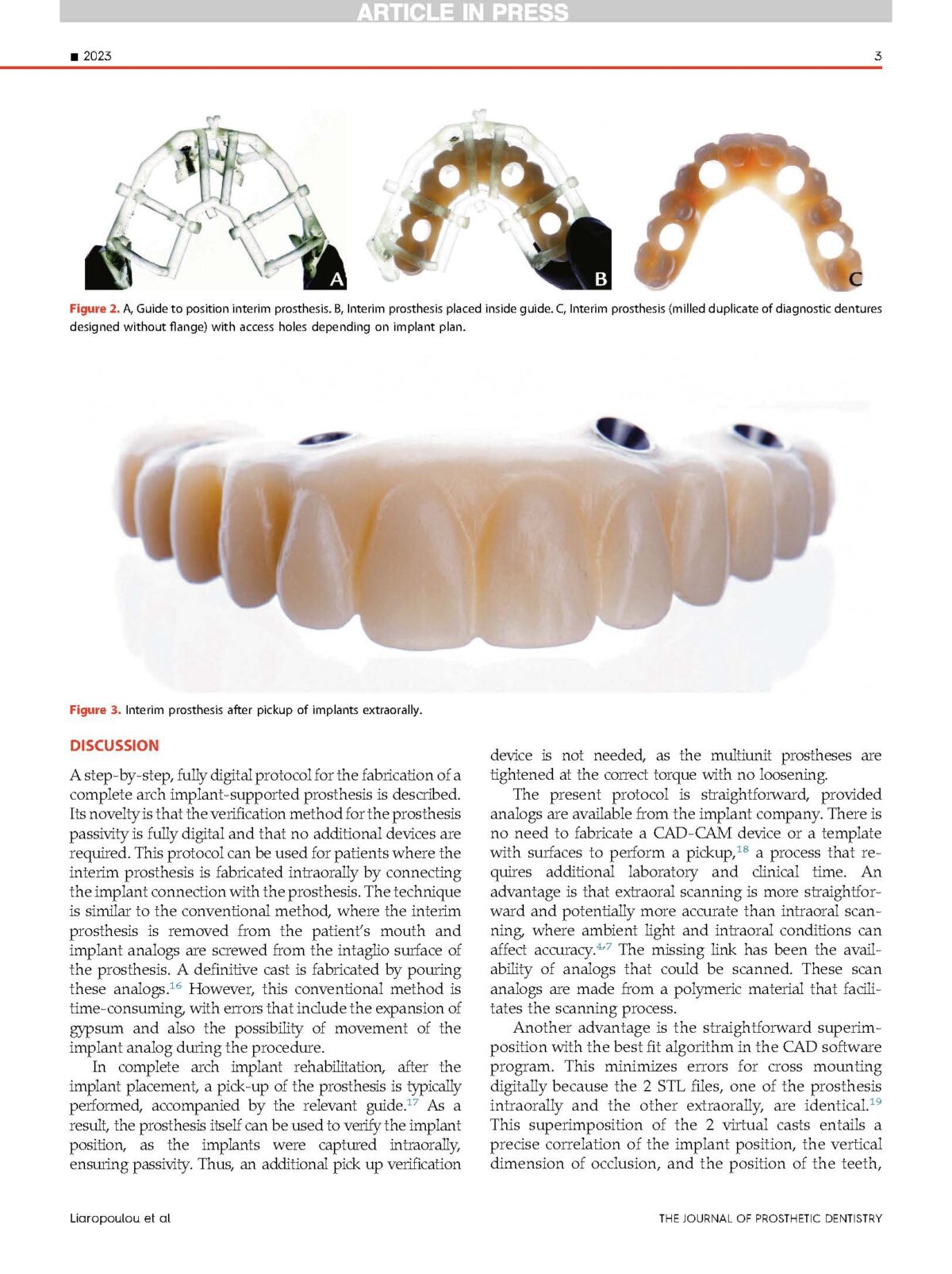 Reverse impression technique: A fully digital protocol for the ...