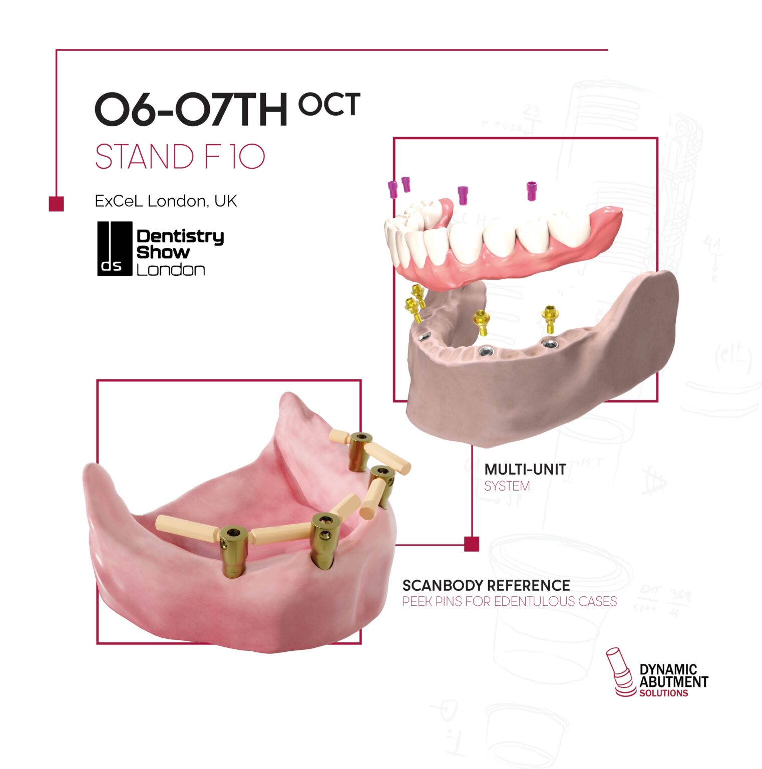 DENTISTRY SHOW LONDON, here we come! | Dynamic Abutment Solutions EN