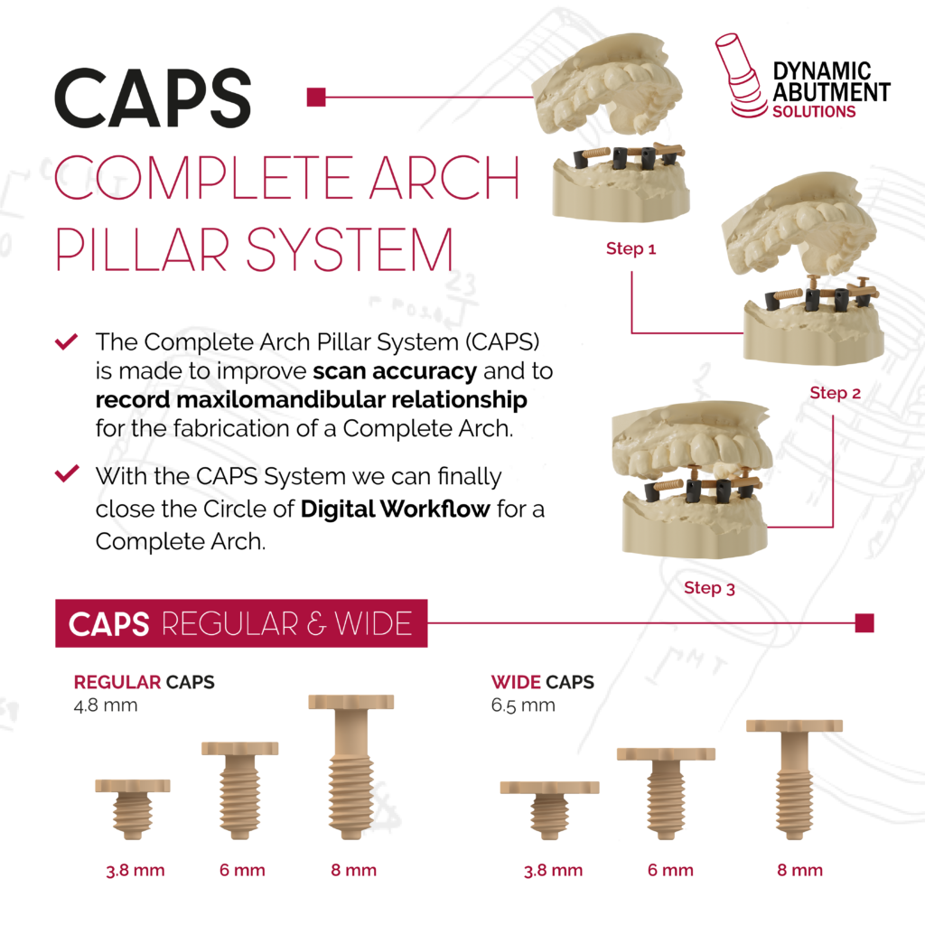 CAPS Complete Arch Pillar System | Dynamic Abutment Solutions EN